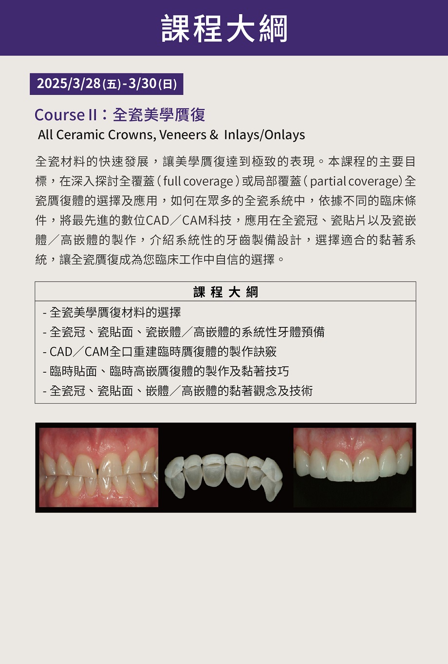 2025年度完整美學植牙暨UW證書班